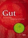 Fibrosing colonopathy | Gut
