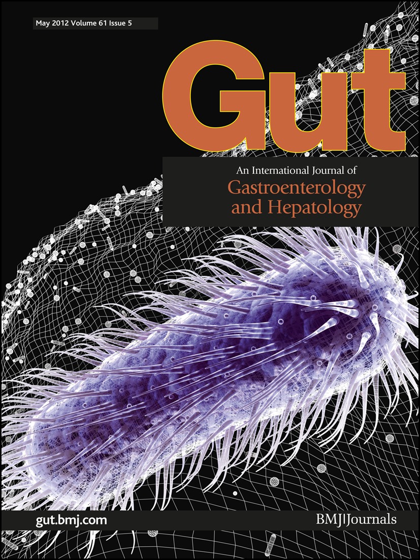 Gastric adenocarcinoma and proximal polyposis of the stomach (GAPPS): a ...